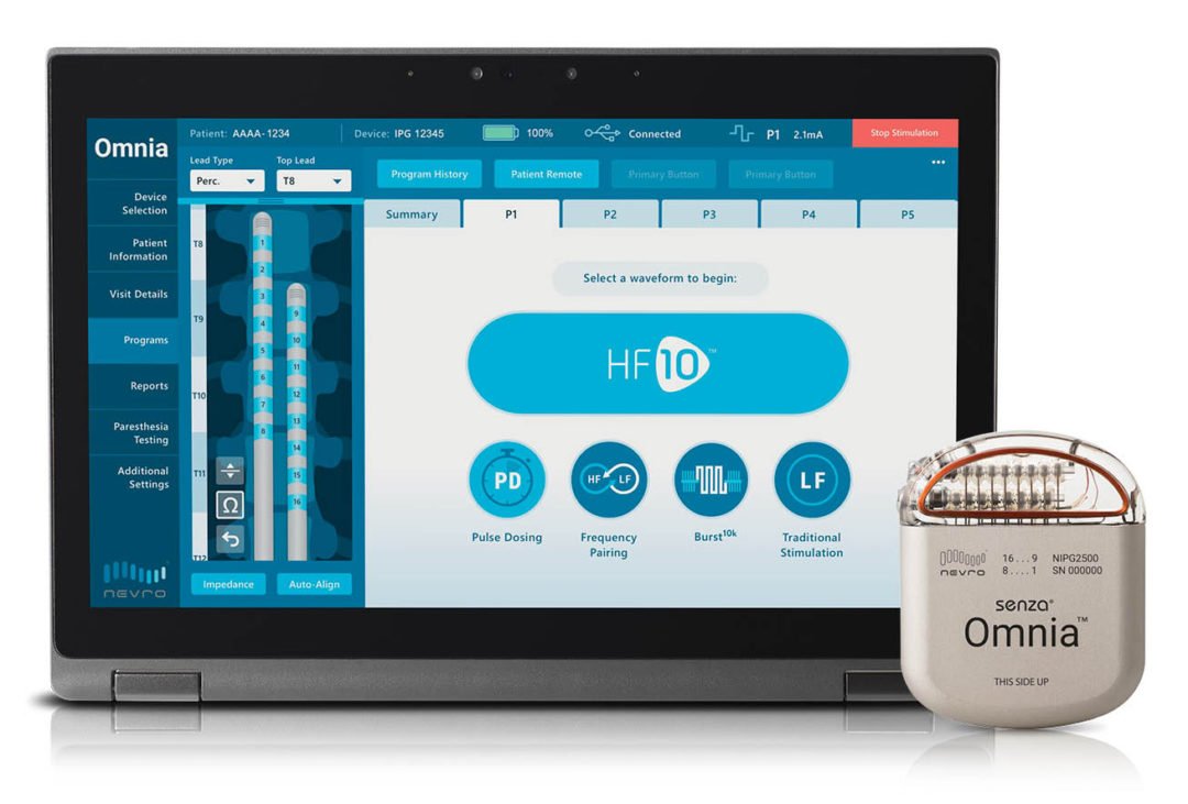 How Nevro Achieves Design Controls Success | Arena